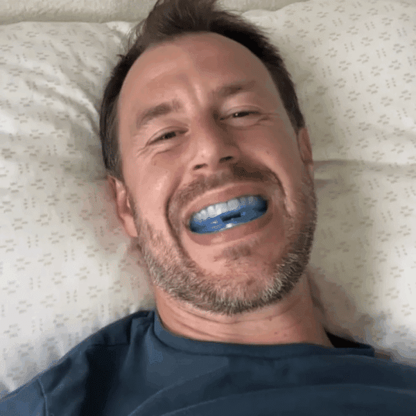 Honex Anti-Snoring Mouthpiece - Official Retailer